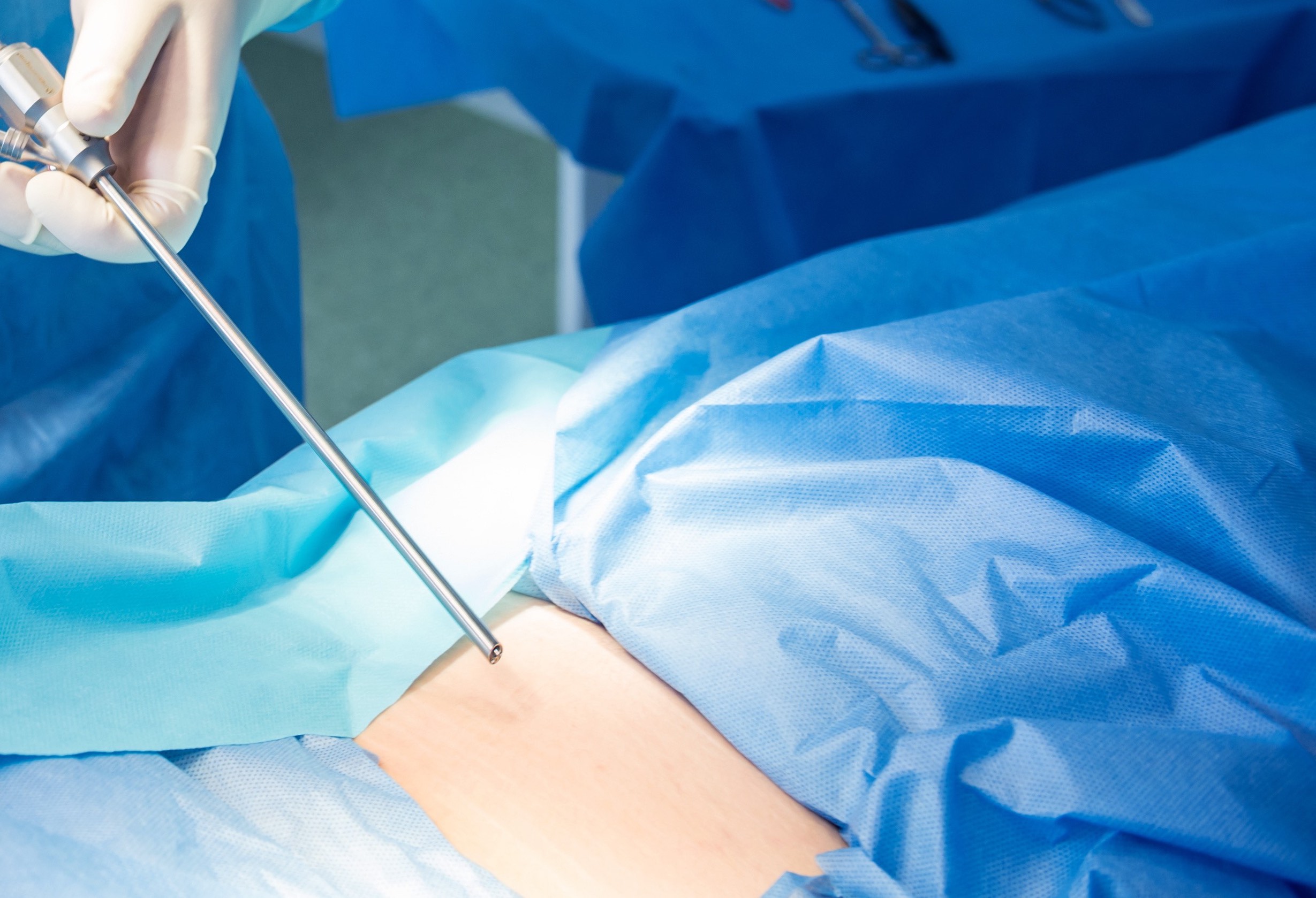 Microdiscectomy Recovery